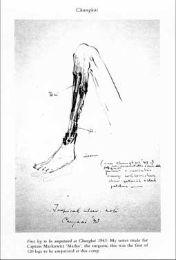 Tropical Ulcers | COFEPOW