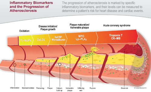 Cardiovascular Inflammation Profile Genetic Optimization
