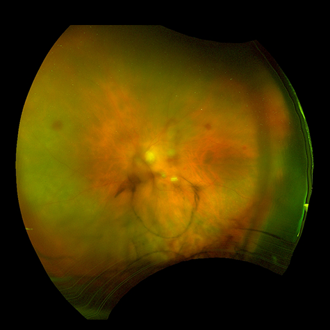 Case of the Month | April 2023