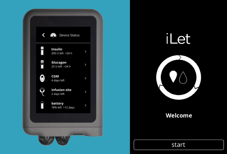 iLet Interface