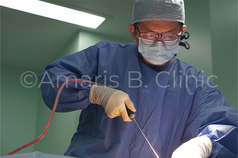 Never Shy Away from Sleeveless Tops Again with This Treatment That Gets ...