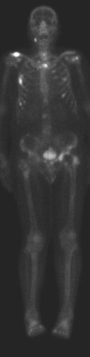 LearnOncology