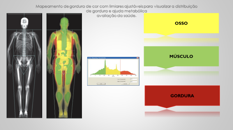 Clinoson | Exame de Avaliação da Composição Corporal (DXA) em Porto ...