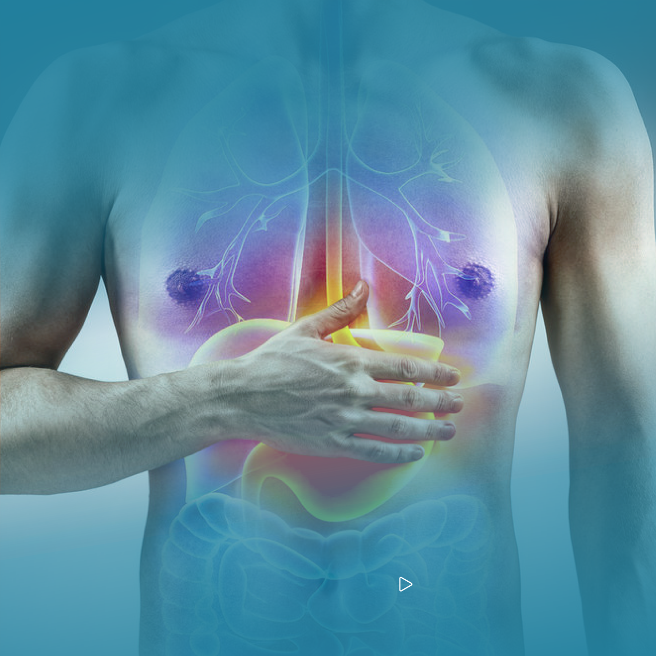 A Evolução no Tratamento da Hérnia - MedCenter | Sua saúde em um só lugar