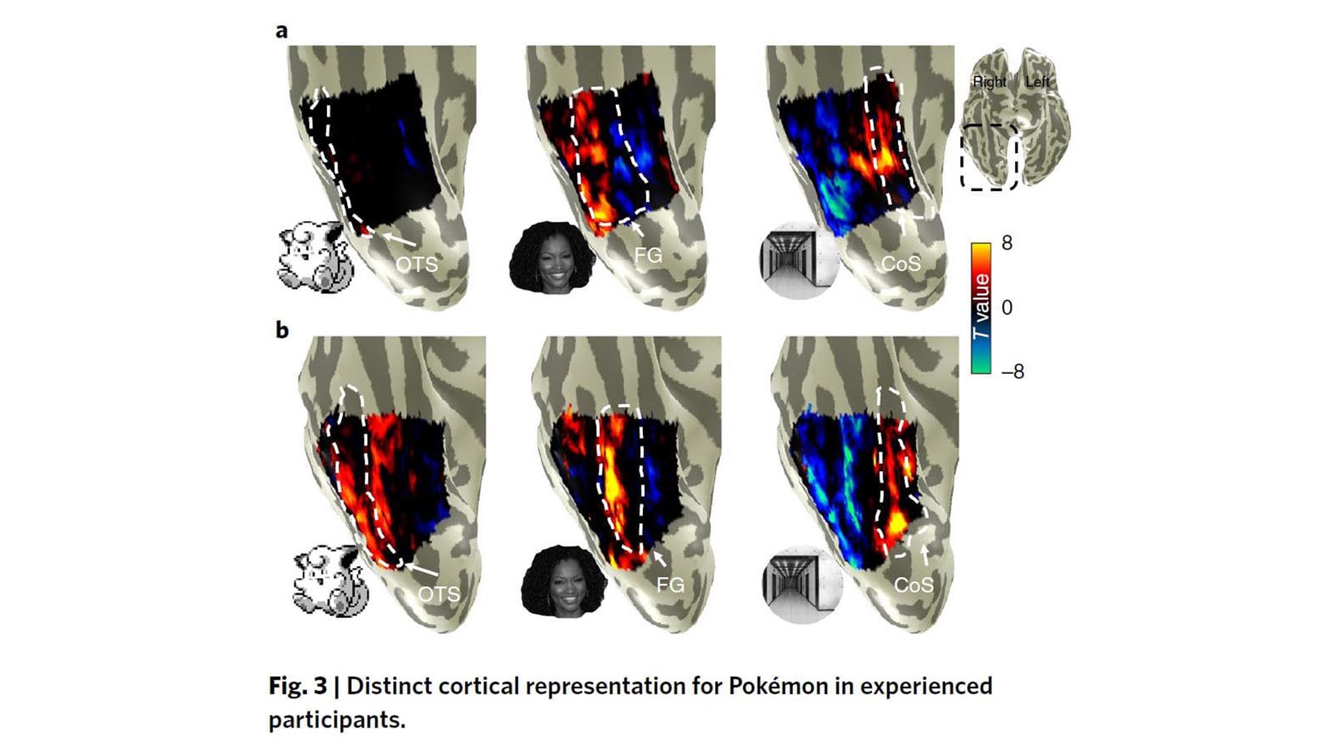 90s Kids Will Remember This: Research says part of your brain is ...