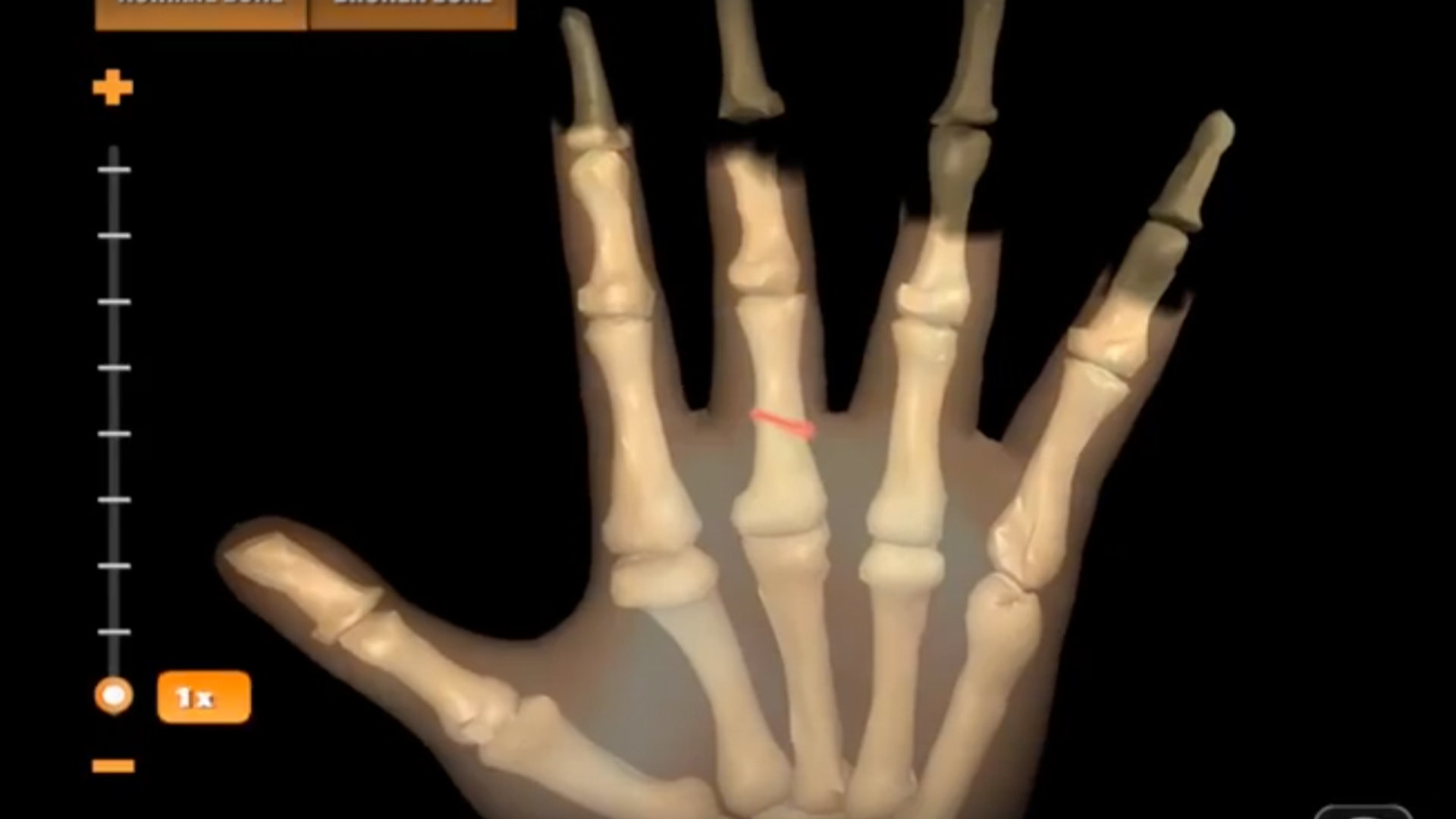 Powers of Minus Ten Bone | The Partnership in Education