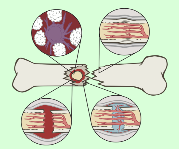 Bone Student Reading Pages | The Partnership in Education