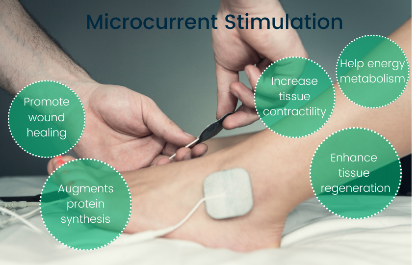 The Impact Microcurrent Stimulation can have on Achille Tendon Injuries ...