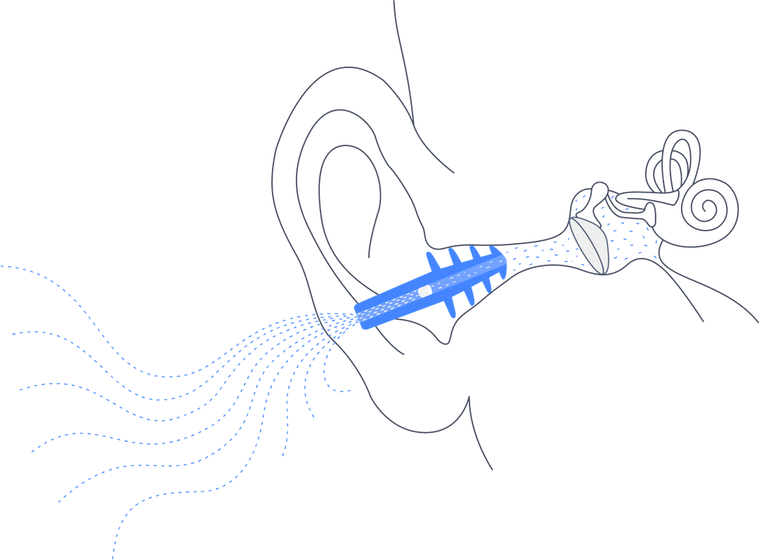 EarPlanes