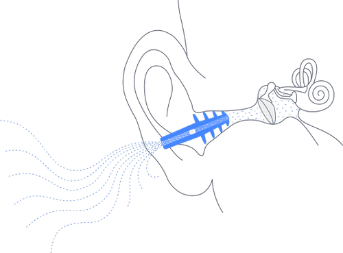 EarPlanes