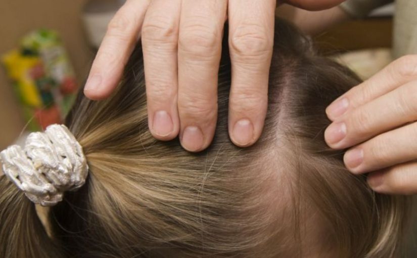 Lice Life: The Brief Wondrous Life of a Head Louse