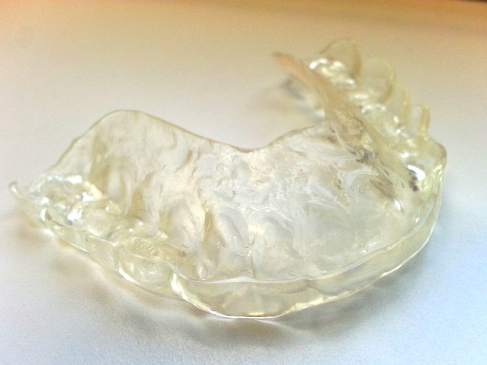 Szabo Zahnarzt Zollikon | Unsere Leistungen