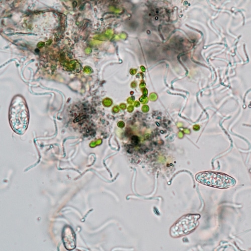 NES - Bacteria, Sewage & Wastewater Testing