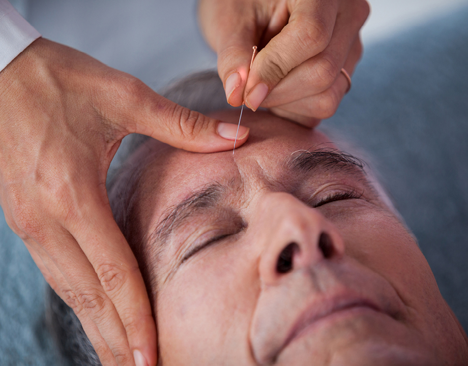 Acupuncture: What Is It and Does Medicare Cover It?