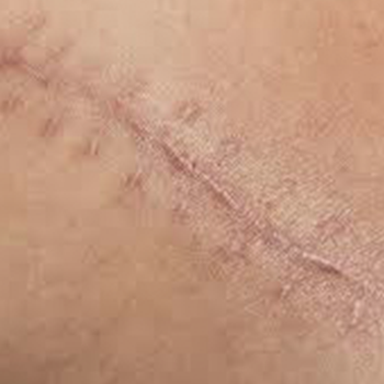Doctor Ursel- Skin Concerns