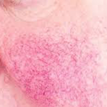Doctor Ursel- Skin Concerns