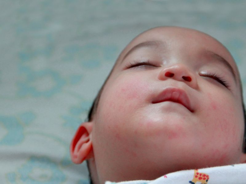 Paediatric febrile neutropenia