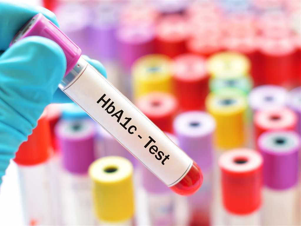 Glycated haemoglobin (HbA1c): A diabetic diagnostic and monitoring test