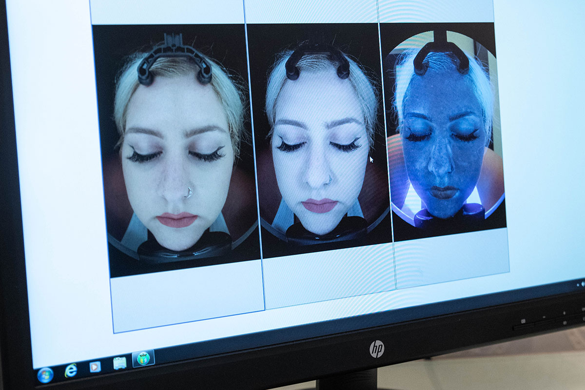 Advanced skin analysis | Nuvo MediSpa