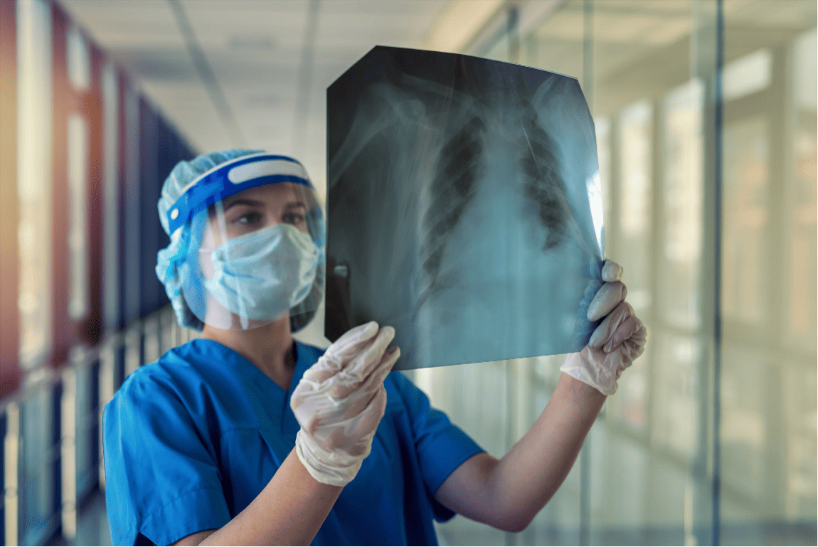 The use of systemic corticosteroids in exacerbations of COPD ...