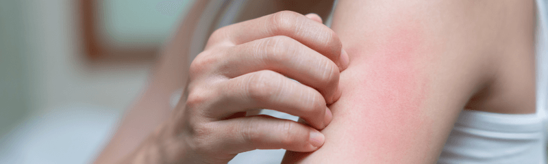 Your Complete Guide to Dealing with Allergies in the Morning