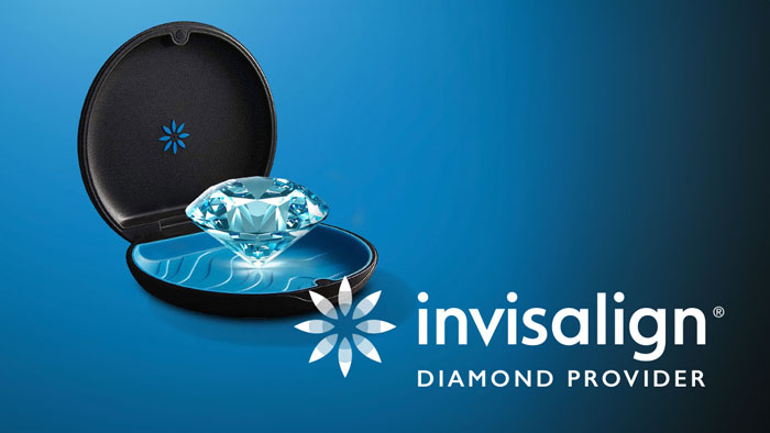 Invisalign Birmingham - Invisible Braces | Clear Aligners