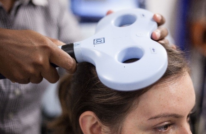 Optimising brain stimulation to help recovery from stroke ...