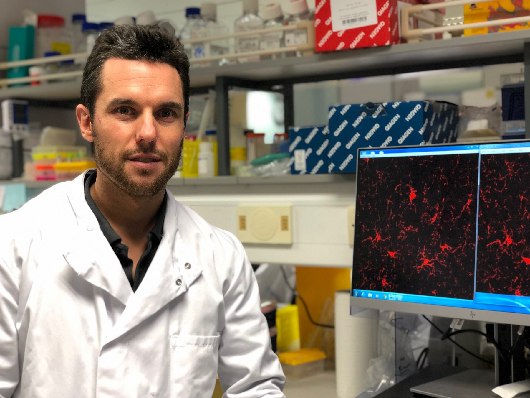 Can immune cells boost recovery after stroke?