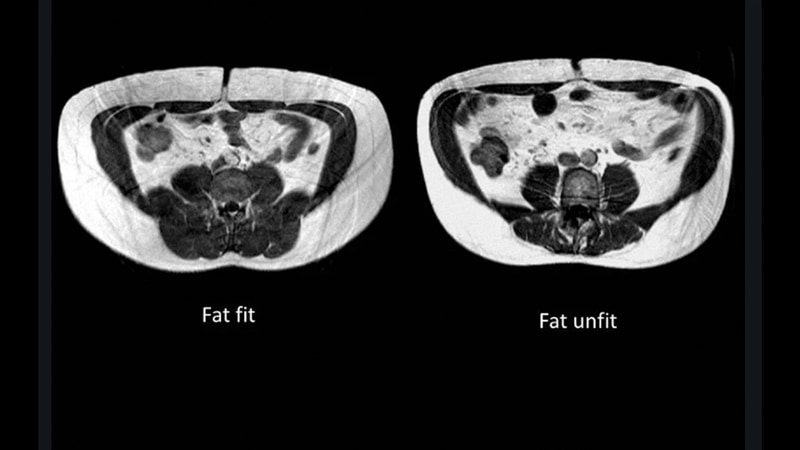 TOFI: Thin on the outside, Fat on the inside