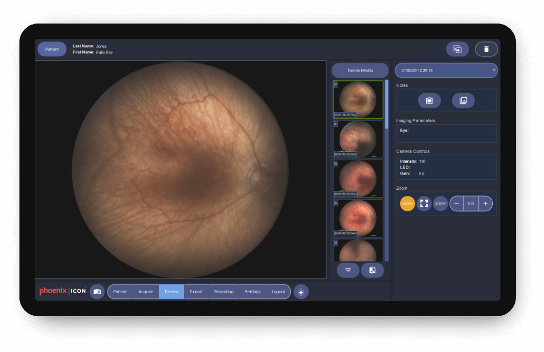 Icon Retinal Imaging System