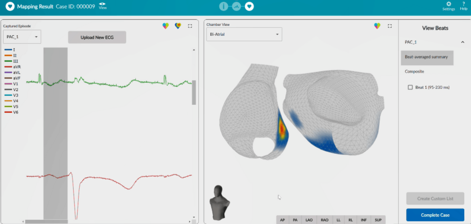 News | Vektor Medical