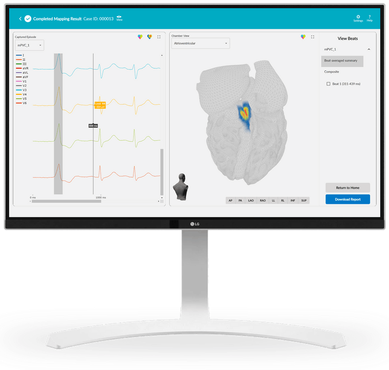 vMap | Vektor Medical