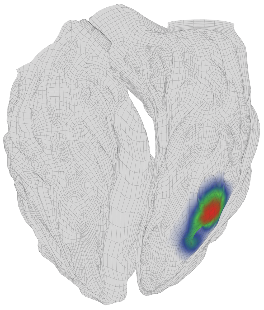 Clinical | Vektor Medical