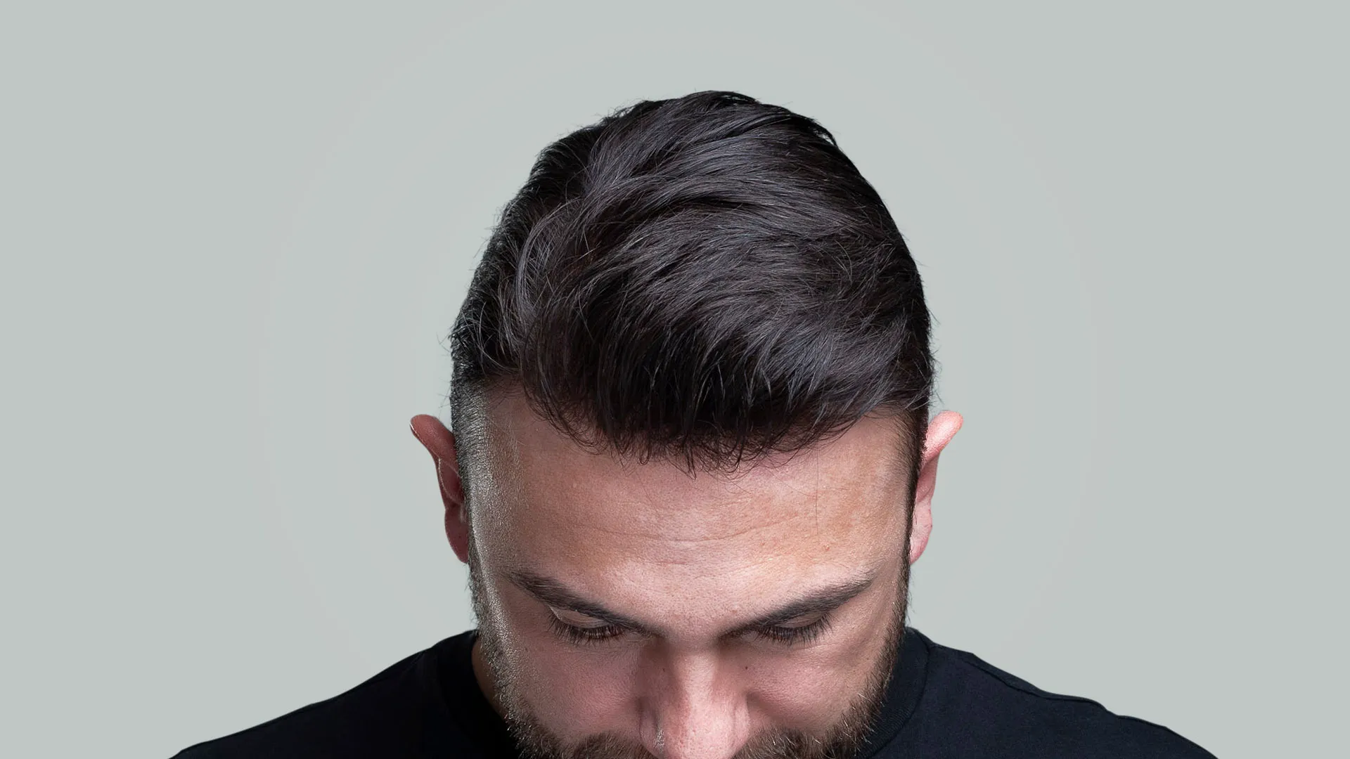 Total Cover Plus: London & UK Non surgical hair replacement system for ...