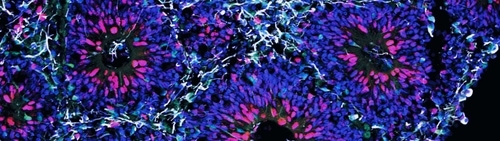 Pharma on Chip - 3Brain