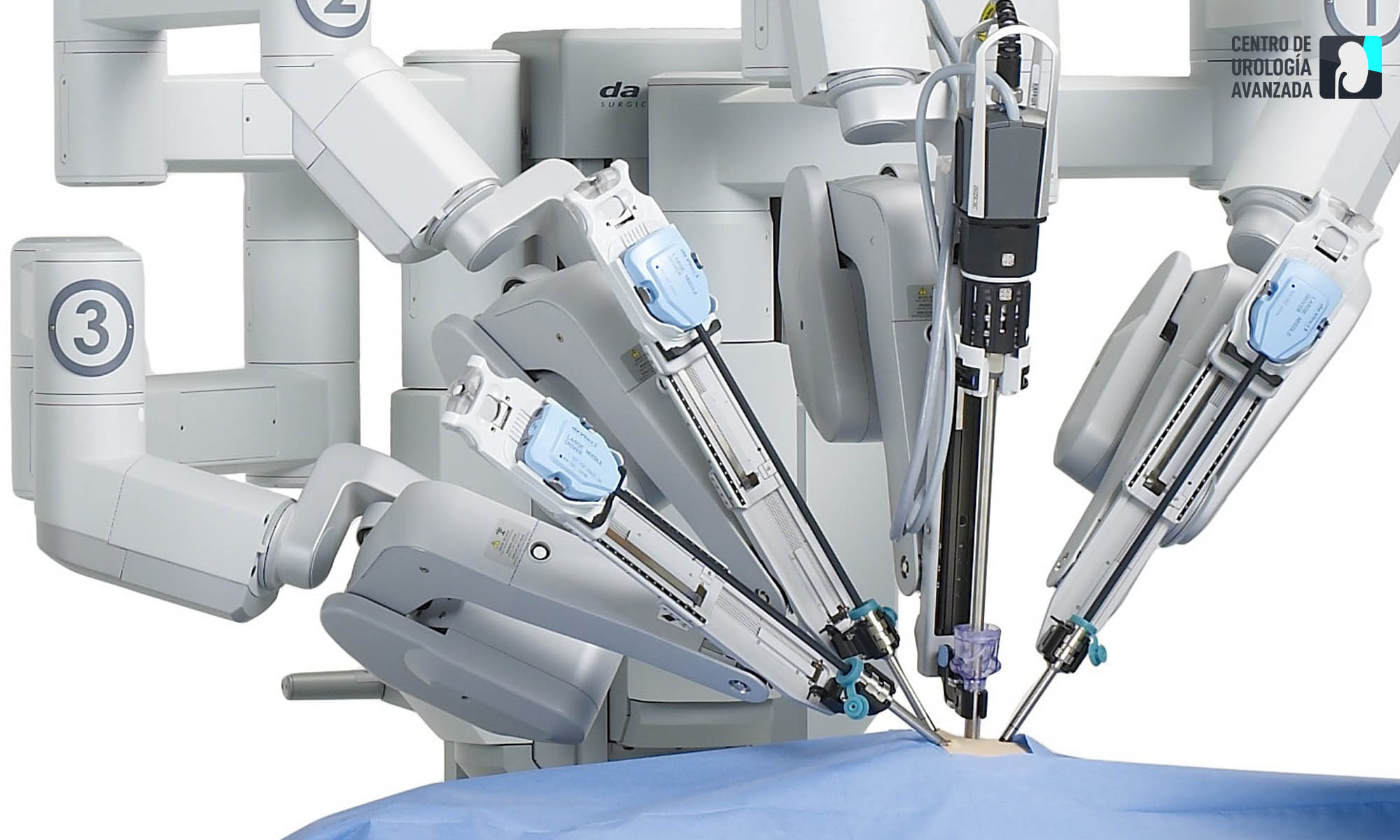 Cirugía Robótica | Centro de Urología Avanzada