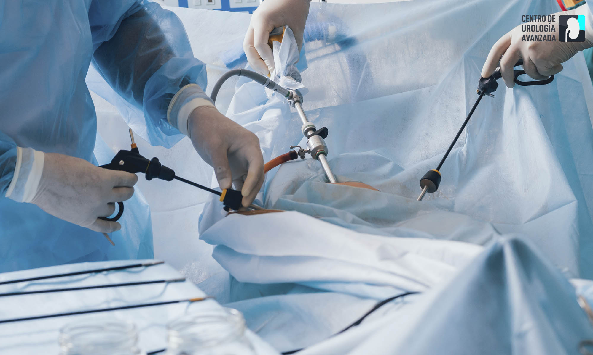 Cirugía laparoscópica | Centro de Urología Avanzada