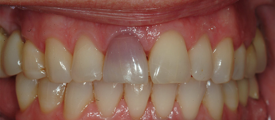 Indianapolis Dentistry — Top Dentist in Indianapolis