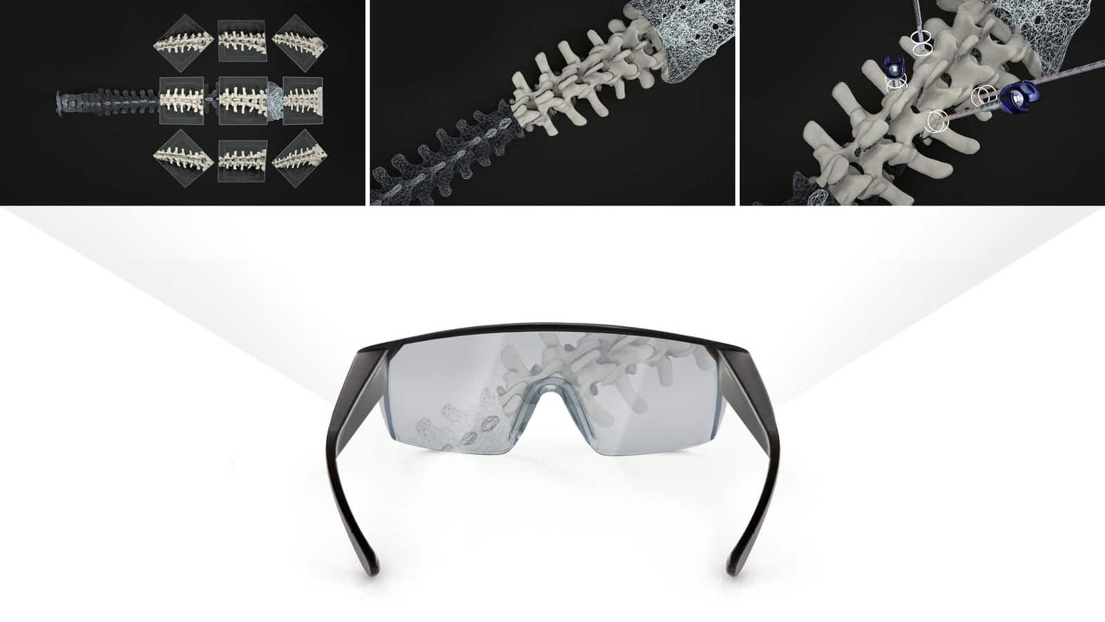 Proprio – Technology