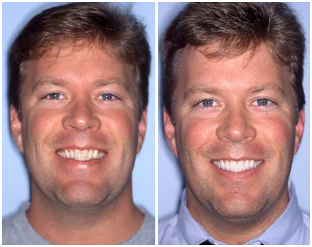 Kenwood Cosmetic Dentistry | Voted Cincinnati's Top Dentist‎