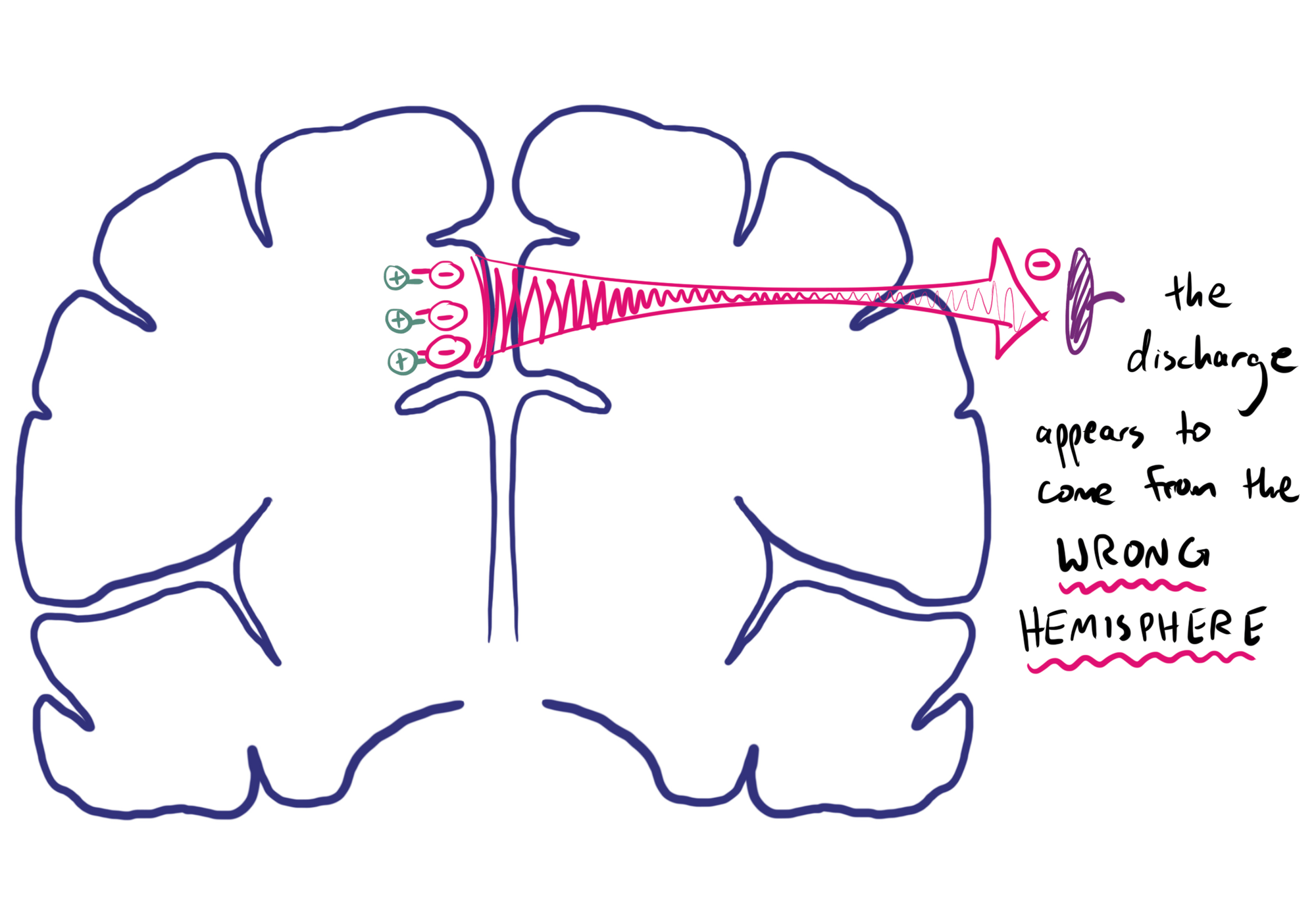 Basic EEG Electrophysiology