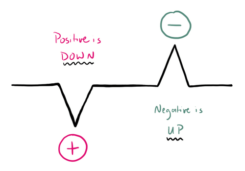Basic EEG Electrophysiology