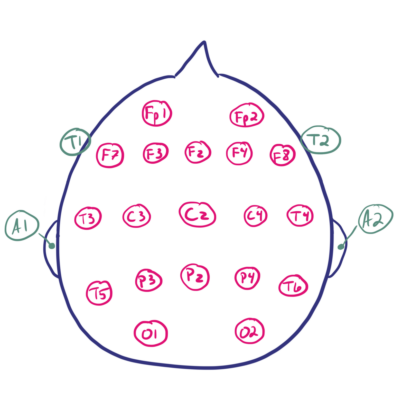 EEG Montages and Technical Components