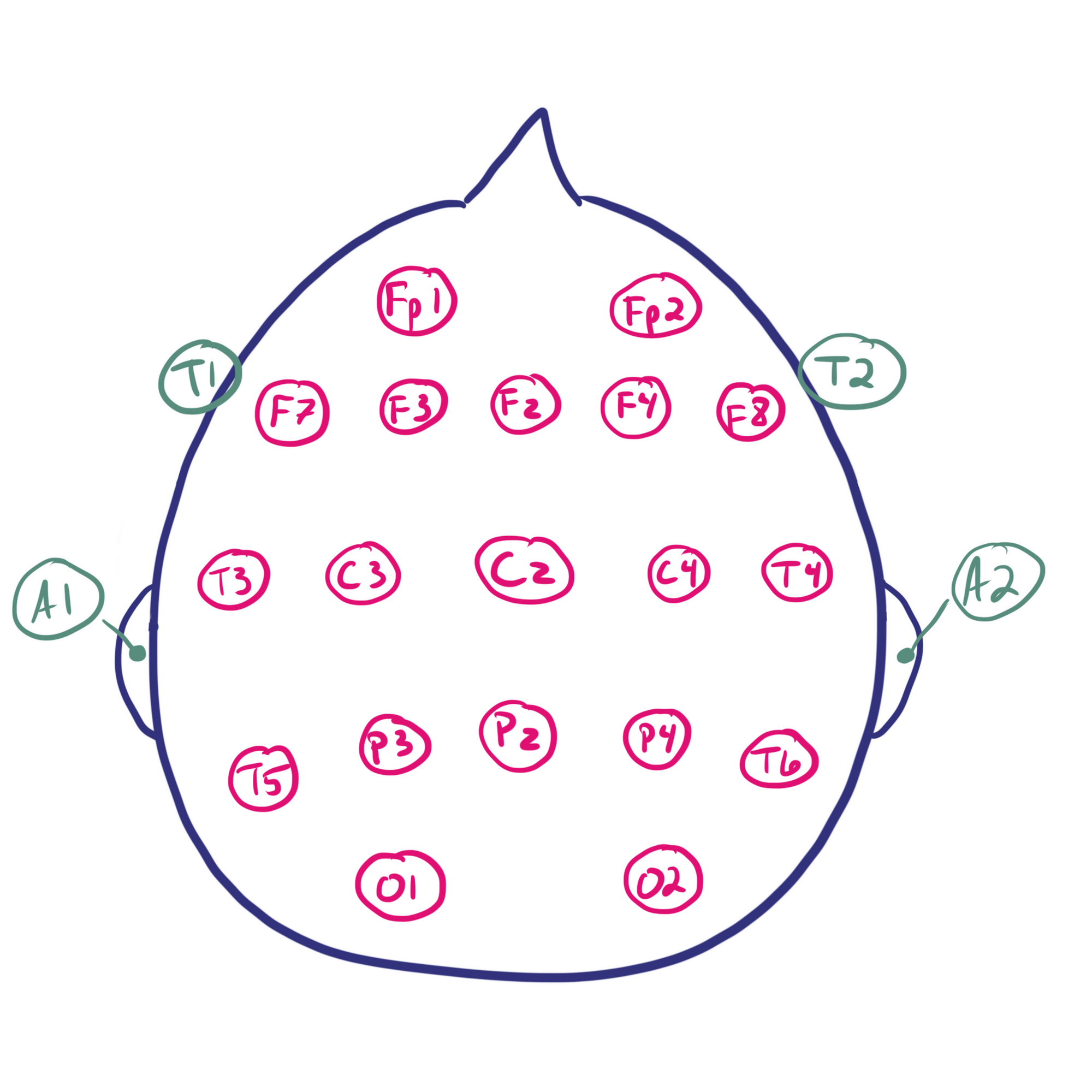 EEG Montages and Technical Components