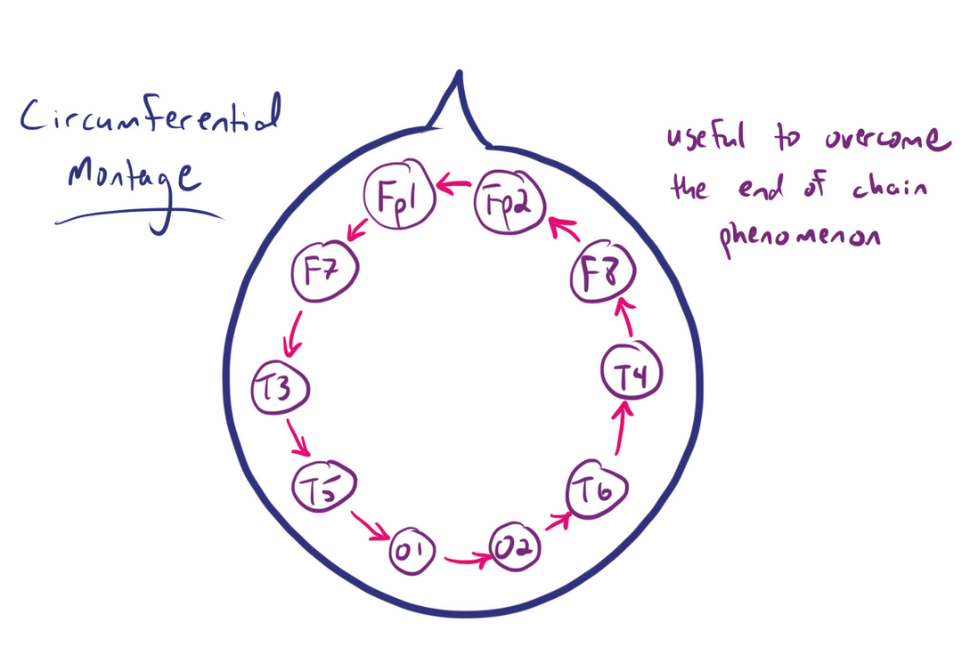 EEG Montages and Technical Components