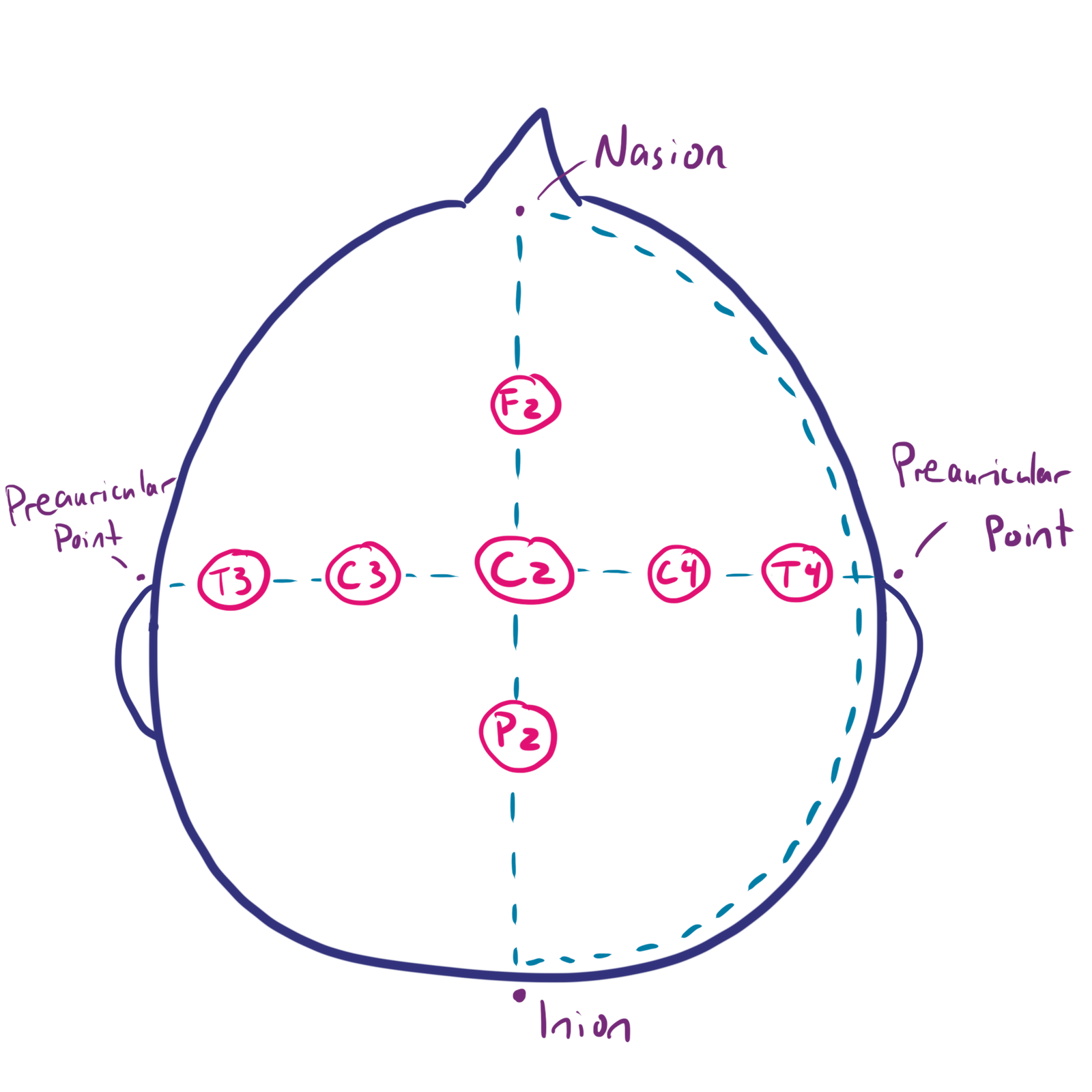 EEG Montages and Technical Components