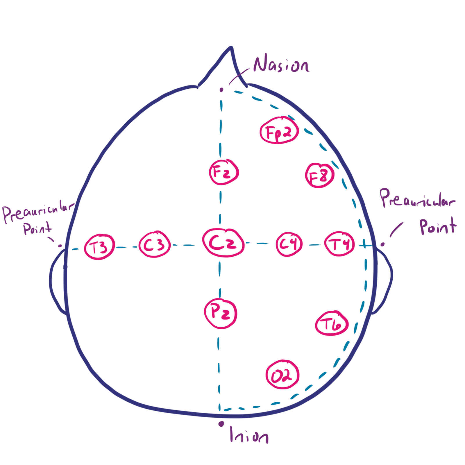 EEG Montages and Technical Components