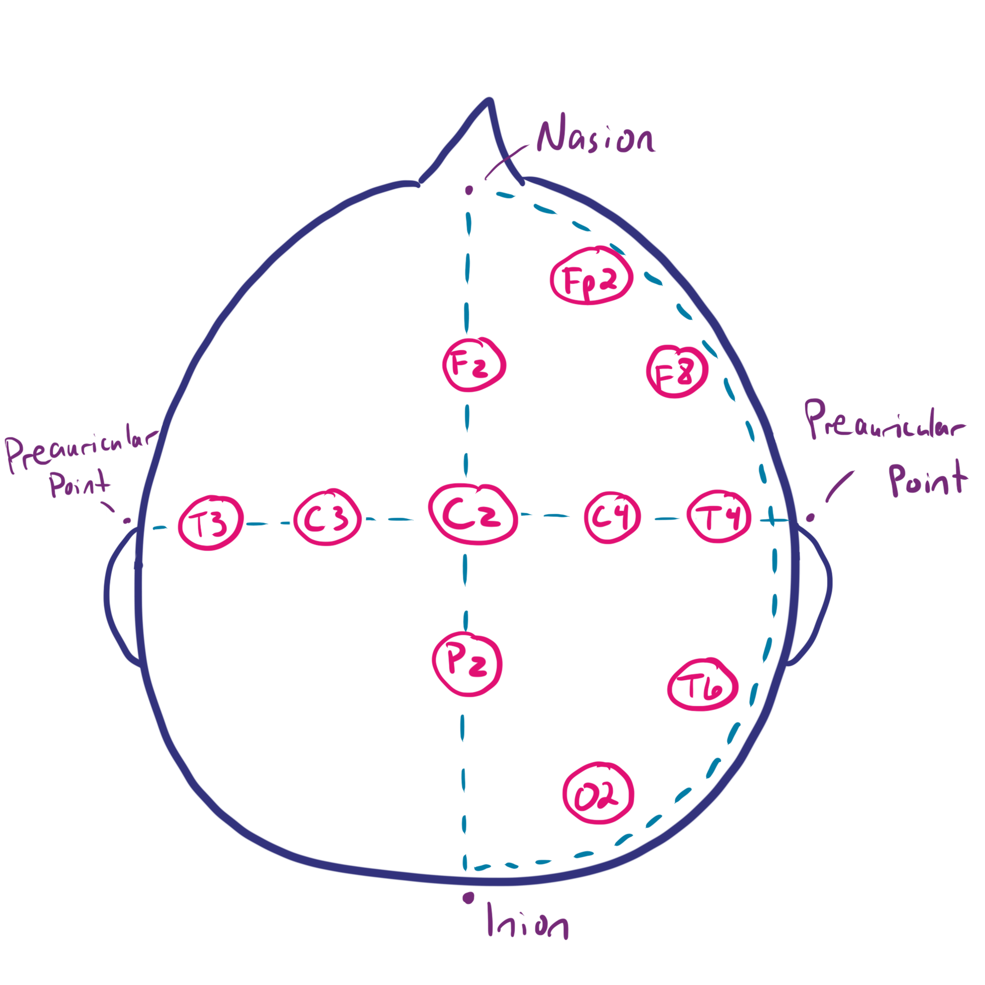 EEG Montages and Technical Components