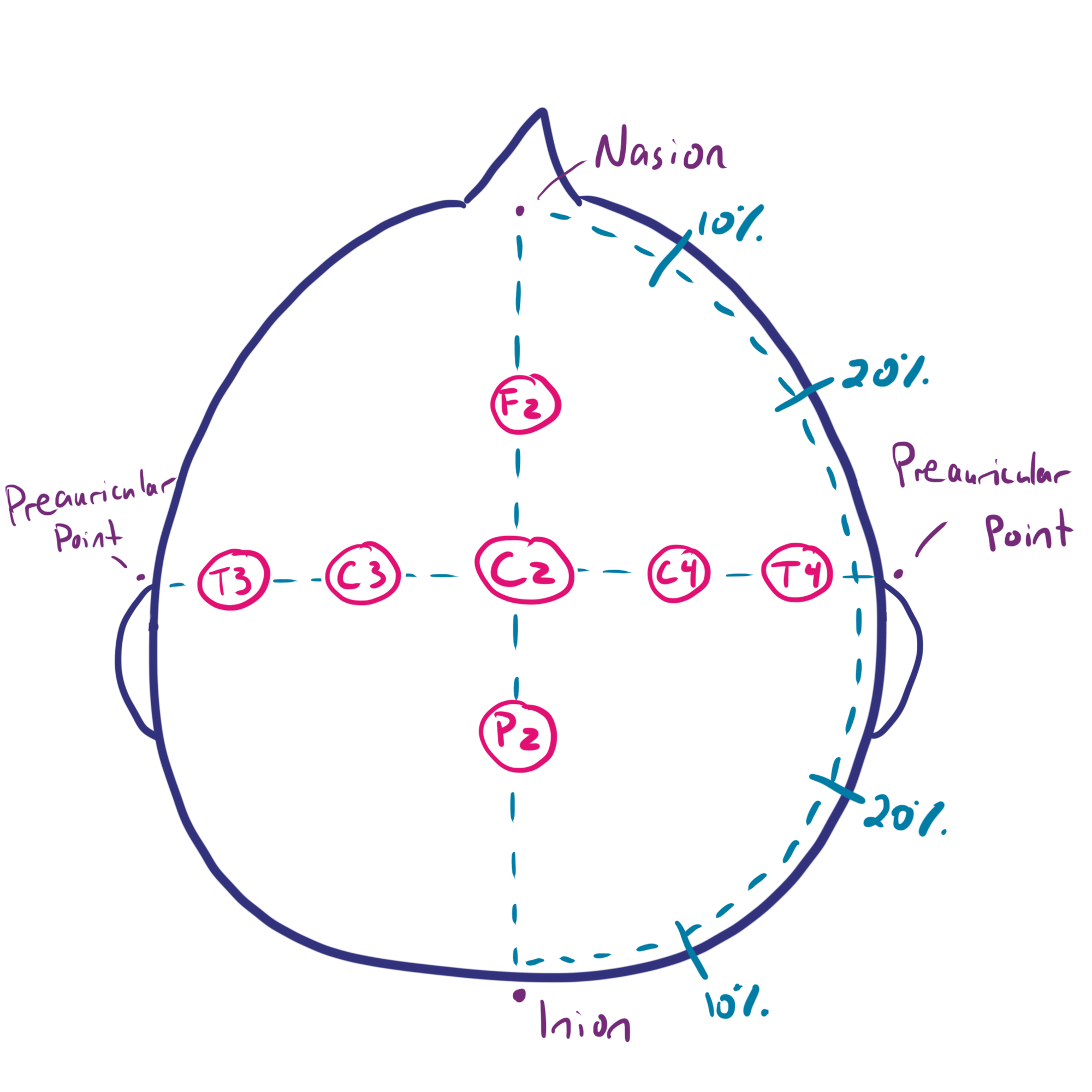 EEG Montages and Technical Components