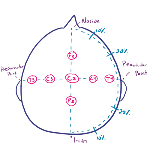 EEG Montages and Technical Components